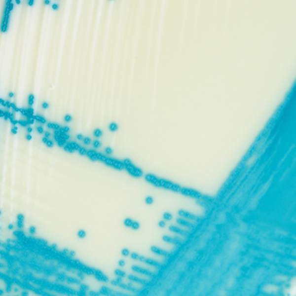 薬剤耐性菌｜CHROMagar｜微生物検査｜製品情報